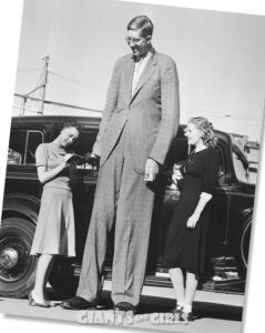 Gigantizam (gigantismus) - Simptomi